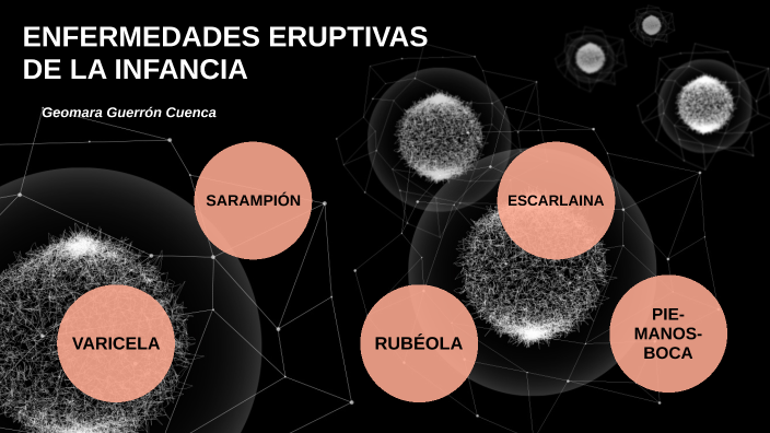 ENFERMEDADES ERUPTIVAS DE LA INFANCIA by Geomara Guerrón on Prezi