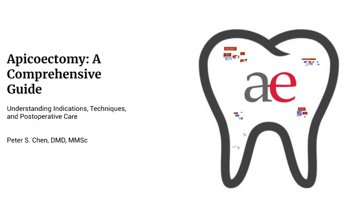 Apicoectomy: A Comprehensive Guide by Madeline Tyrrell on Prezi