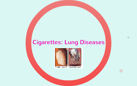 Science project. Cigarettes: Lung Diseases by Maria Pardo on Prezi