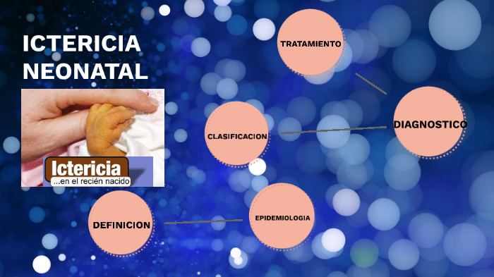 Ictericia Neonatal By Allison Liliana Alvarez Aduvuri On Prezi