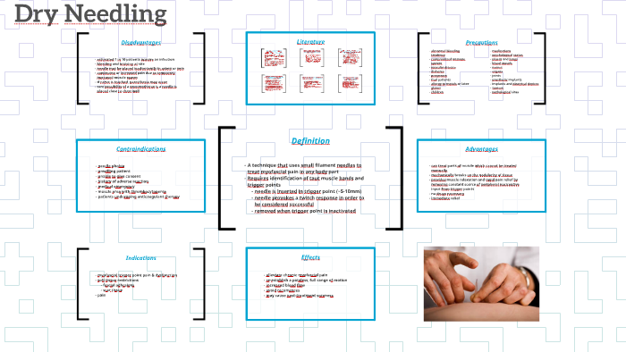 Dry Needling by on Prezi