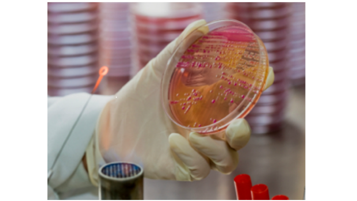 CONFIRMAÇAO DA EFICÁCIA DO TESTE DE HODGE MODIFICADO ATRAVES atual by ...