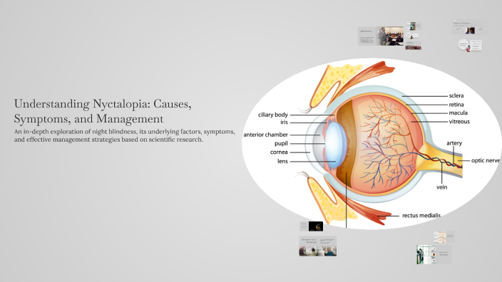 Understanding Nyctalopia: Causes, Symptoms, and Management by Madeline ...