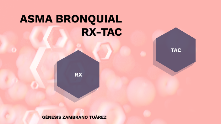 ASMA BRONQUIAL TAC Y RX by Génesis Zambrano on Prezi