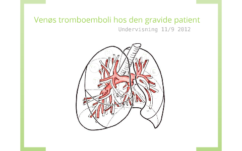 Lungeemboli hos den gravide patient by Maria Grevit on Prezi