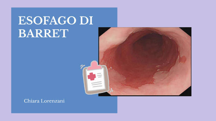 ESOFAGO DI BARRETT by Chiara Lorenzani on Prezi