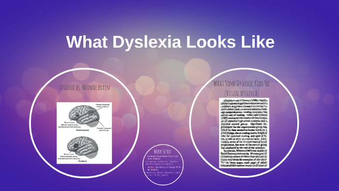 What Dyslexia Looks Like by kylee martinez on Prezi