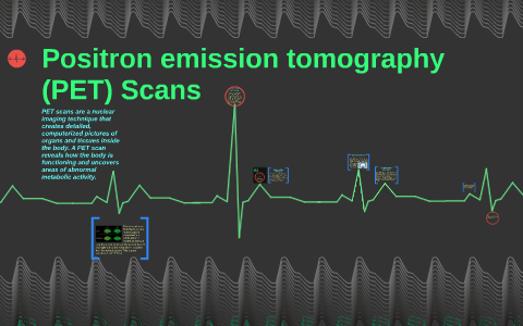Positron emission tomography by lakin roberts on Prezi