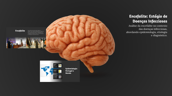 Encefalite: Estágio de Doenças Infecciosas by Beatriz Guerreiro on Prezi