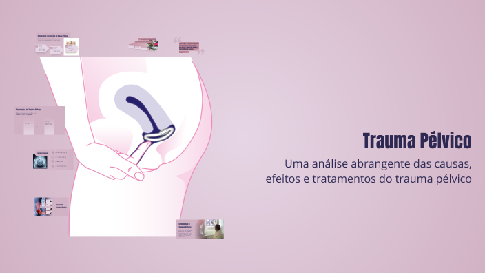 Trauma Pélvico by VANESSA GONZALEZ on Prezi