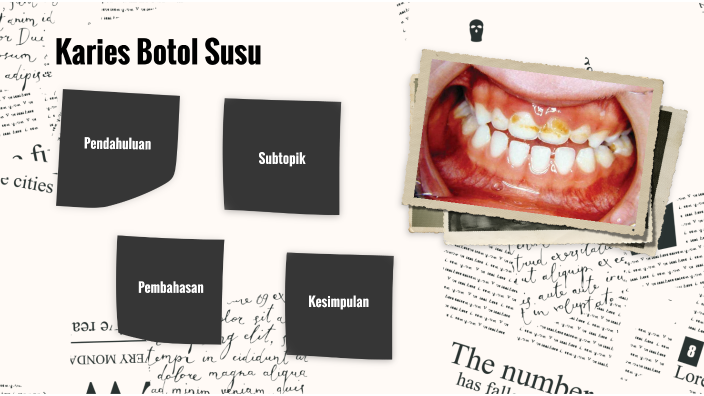 Karies Botol Susu by Dyone Wong on Prezi