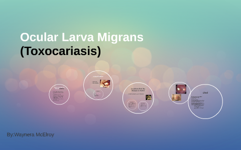 Ocular Larva Migrans by Waynera McElroy on Prezi