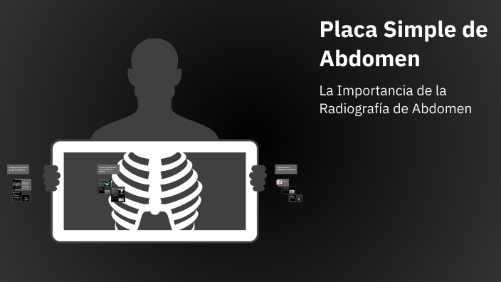 Placa Simple de Abdomen by casa medica ac on Prezi