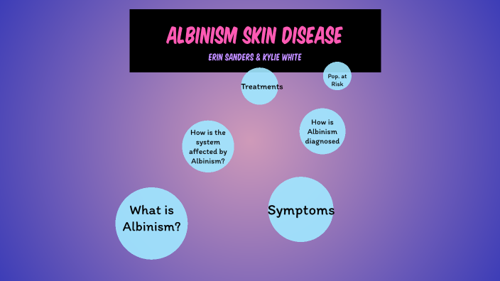 Albinism Presentation by Erin Sanders on Prezi