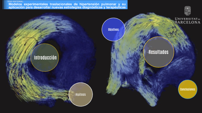 Tesis by Daniel Pereda Arnau on Prezi