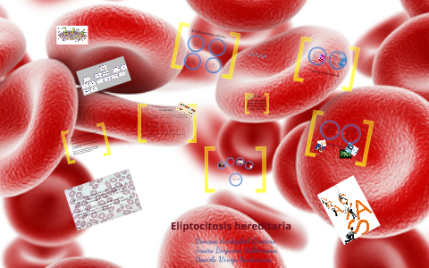 Ovalocitosis hereditaria by Vanessa Aristizabal on Prezi