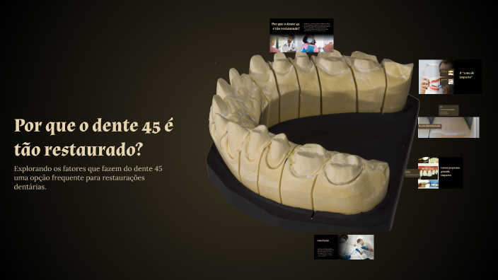 Por que o dente 45 é tão restaurado? by Ana Craveiro on Prezi