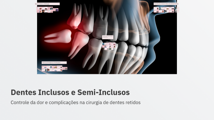 Dentes Inclusos e Semi-Inclusos by Anaila Híngrete Fernandes Santos on ...