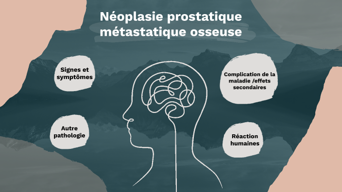 Modèle trifocal by Manon Le Bacq on Prezi