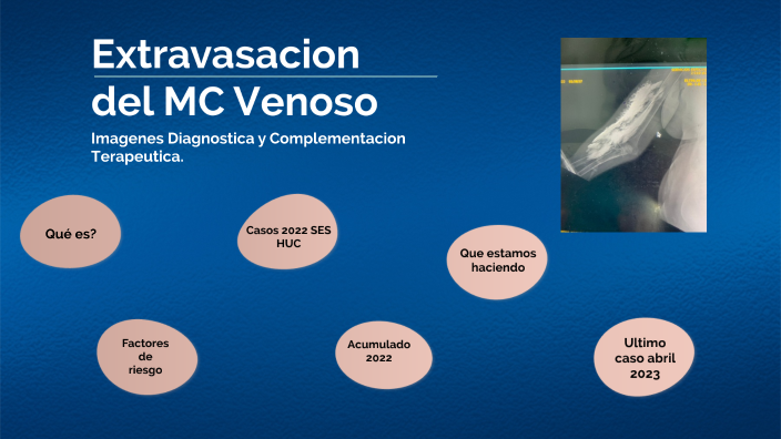 Extravasación del medio de contraste venoso by Diana Clemencia García ...