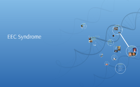 ECC Syndrome by on Prezi