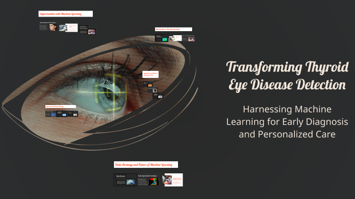 Transforming Thyroid Eye Disease Detection by Shuajb Rexhepi on Prezi