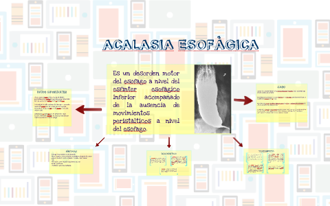 ACALASIA ESOFAGICA by Emily Armijo Ibarra on Prezi