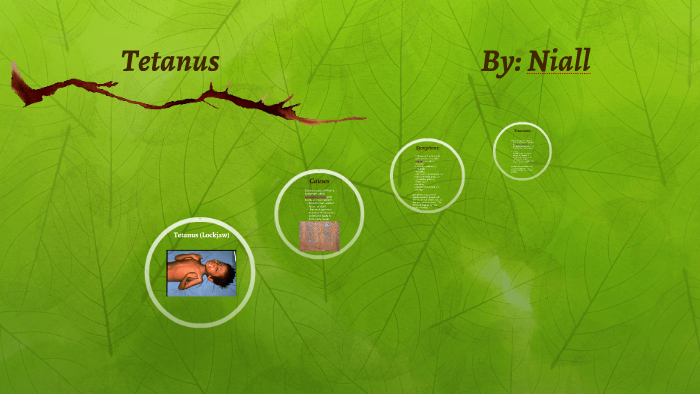 Tetanus (Lockjaw) by Niall Smile on Prezi
