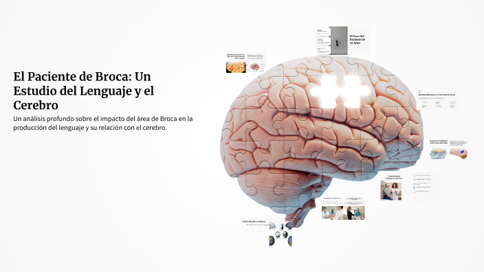 El Paciente de Broca: Un Estudio del Lenguaje y el Cerebro by Sebastián ...