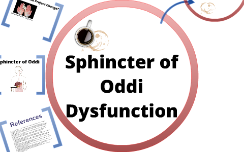 Sphincter of Oddi Dysfunction by Richard Muswell on Prezi