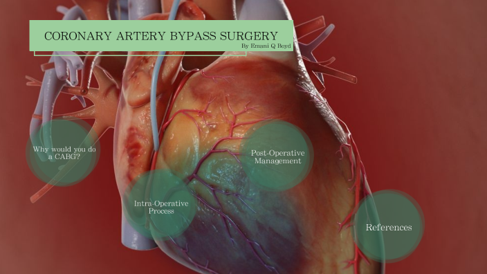 Coronary Artery Bypass Surgery by Emani Boyd on Prezi