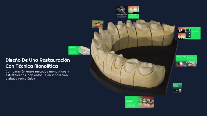 Restauraciones Monolíticas en Prótesis Dental by Yanira Fuentes Luna on ...