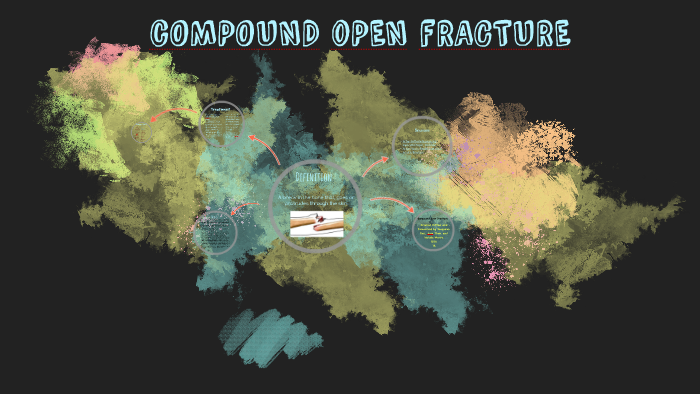 cOMPOUND oPEN fRACTURE by Natalia Morris on Prezi