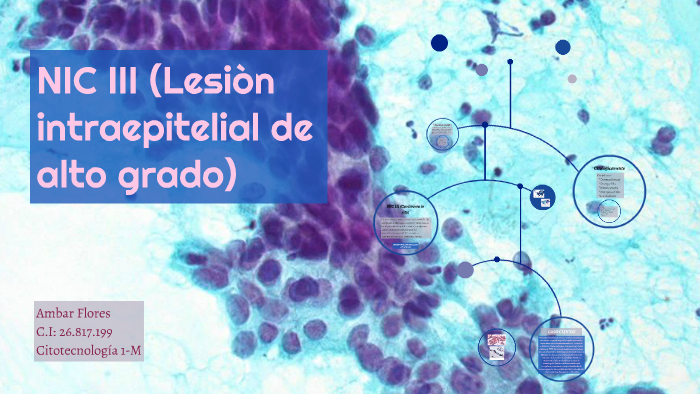 NIC III (Lesiòn intraepitelial de alto grado) by isidro gonzalez on Prezi