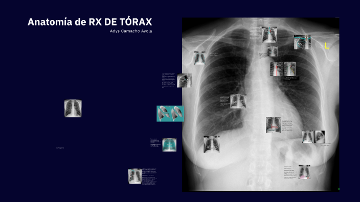 Anatomia de RX DE TORAX by adys camacho on Prezi