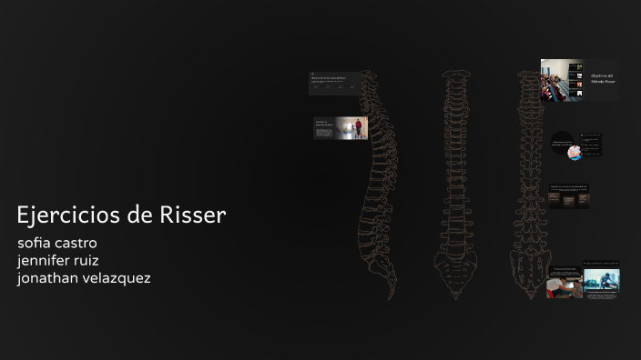Ejercicios De Risser By Antonio Velazquez Serna On Prezi