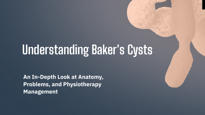 Understanding Baker's Cysts by Amy Lindo on Prezi