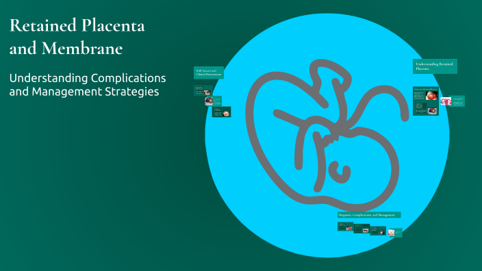Retained Placenta and Membrane by Mugilan M on Prezi