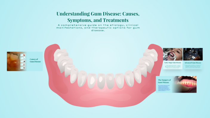Understanding Gum Disease: Causes, Symptoms, and Treatments by Johnna ...