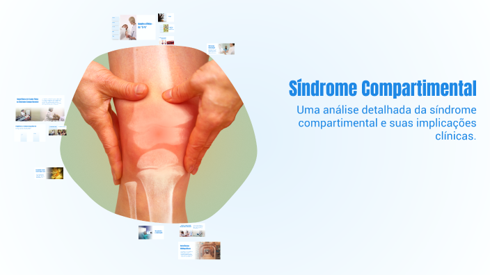 Síndrome Compartimental by on Prezi