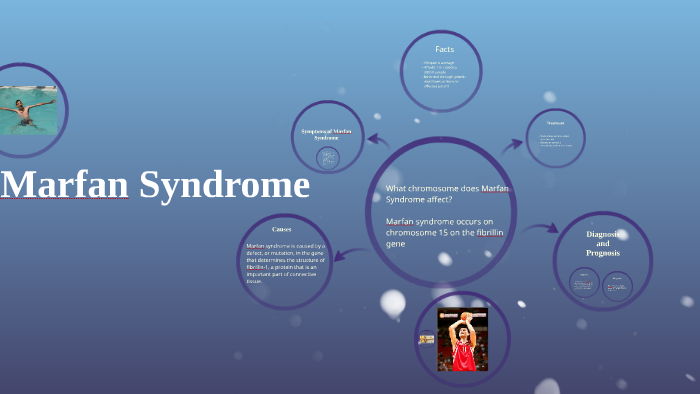 Marfan Syndrome by thomas Pritz on Prezi