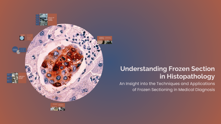Understanding Frozen Section in Histopathology by Mjhool D on Prezi
