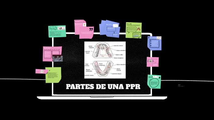 PARTES DE UNA PROTESIS PARCIAL PPR by fivij82024@wuzak.com fivij82024 ...