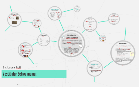 Acoustic Neuroma/Vestibular Schwannoma by Laura Poff on Prezi