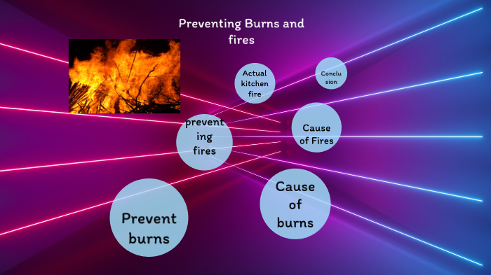 preventing burns and fires by Kenneth Vega on Prezi