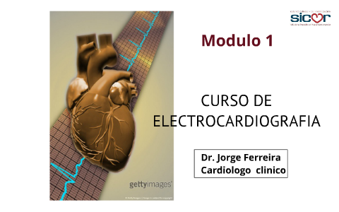 ELECTROCARDIOGRAMA by alex mauricio peñaranda amado on Prezi