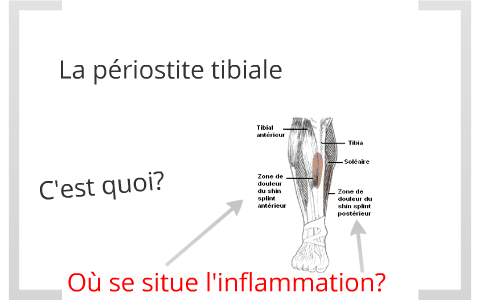 La périostite tibiale by Isabelle Tardif on Prezi
