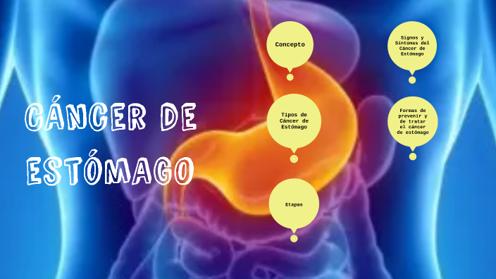 Cáncer de Estómago by Adriana Salinas on Prezi