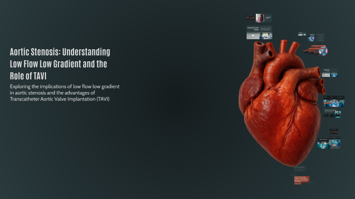 Aortic Stenosis: Understanding Low Flow Low Gradient and the Role of ...