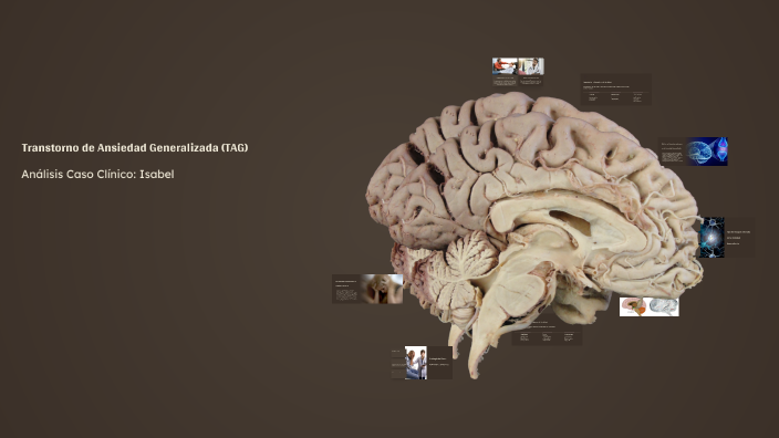 Ansiedad Generalizada: Un Enfoque Científico y Biológico by Jacob ...
